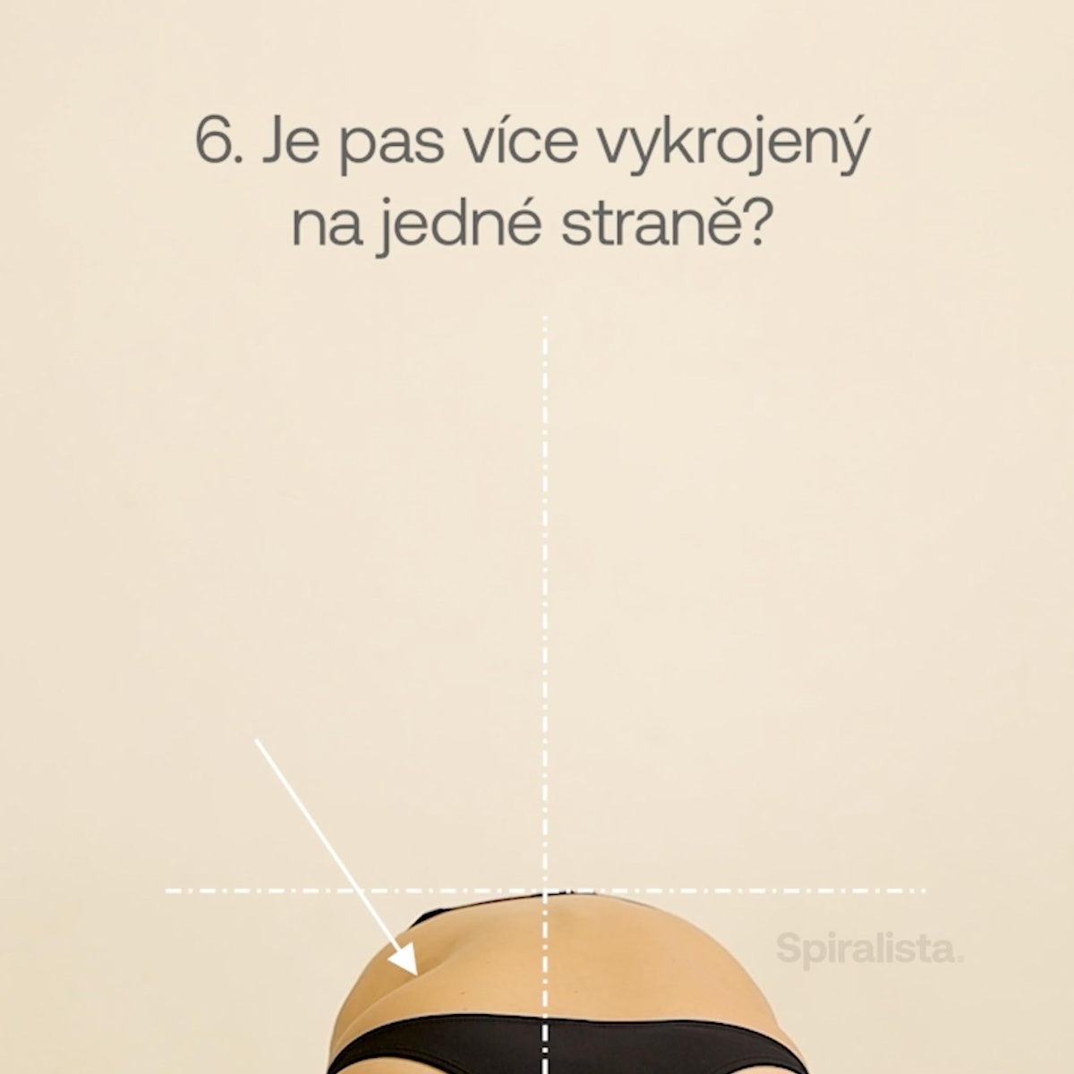 Skolióza u dětí - diagnostika, prevence a léčba metodou Spirální ...